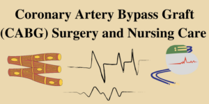 Coronary Artery Bypass Graft (CABG) Surgery and Nursing Care - Nurses ...
