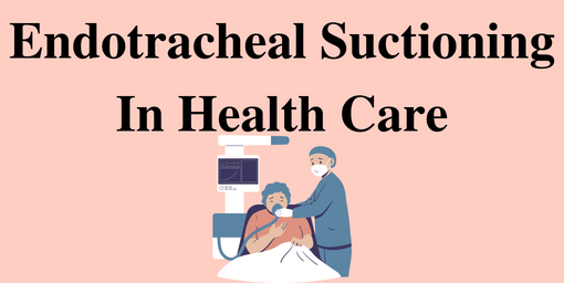 Endotracheal Suctioning In Health Care - Nurses Educator Endotracheal Suctioning In Health Care - Nurses Educator